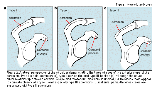 Acromion Types