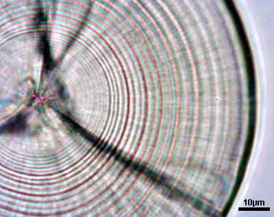 Pedro Ré's Home Page Larval Otolith Microstructure