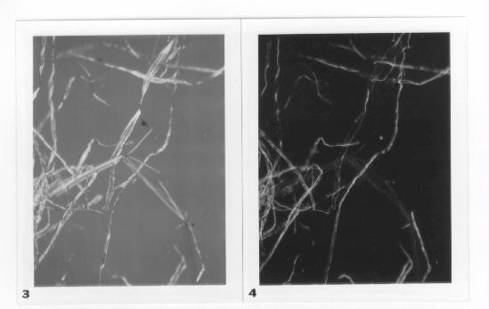 Polarized Light Microscopy Asbestos