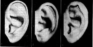 Anatomical landmarks on the ear