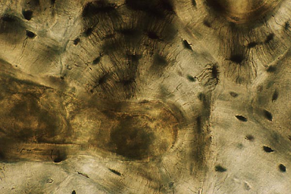 Teixits connectius Teixits connectius