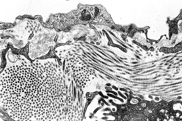 Teixits connectius Teixits connectius