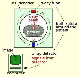 Pet Scan Machine Diagram