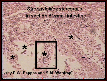 Strongyloides stercoralis