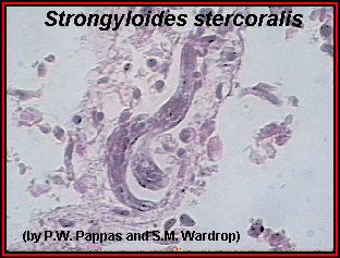 Strongyloides stercoralis