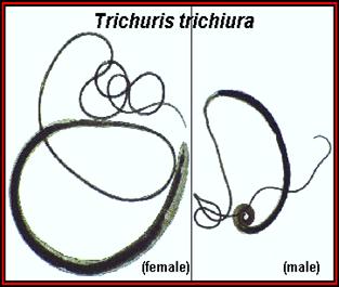 Trichuris trichiura