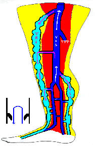 Várices - Preguntas y Respuestas