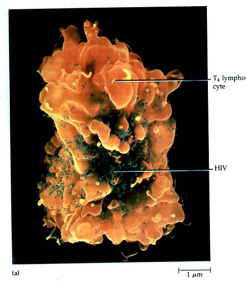 HIV picture