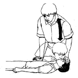 REANIMACION CARDIOPULMONAR BÁSICA EN NIÑOS