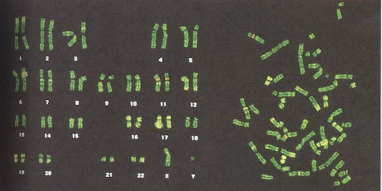 chromosomes