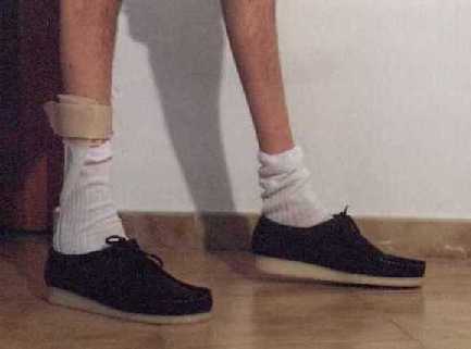 The Problem of Acceptance of AFO's in Charcot-Marie-Tooth Disease