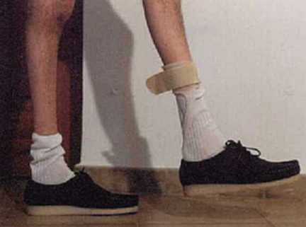 The Problem of Acceptance of AFO's in Charcot-Marie-Tooth Disease