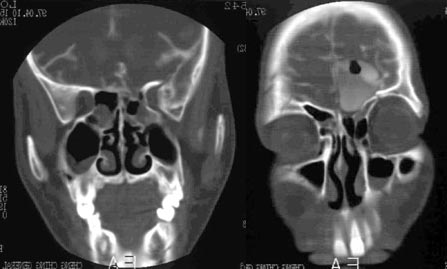 04 CT 相關的技術 Advanced techniques