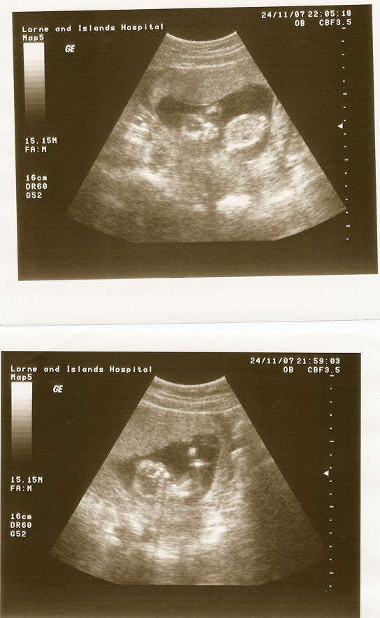 FirstScan firstscan