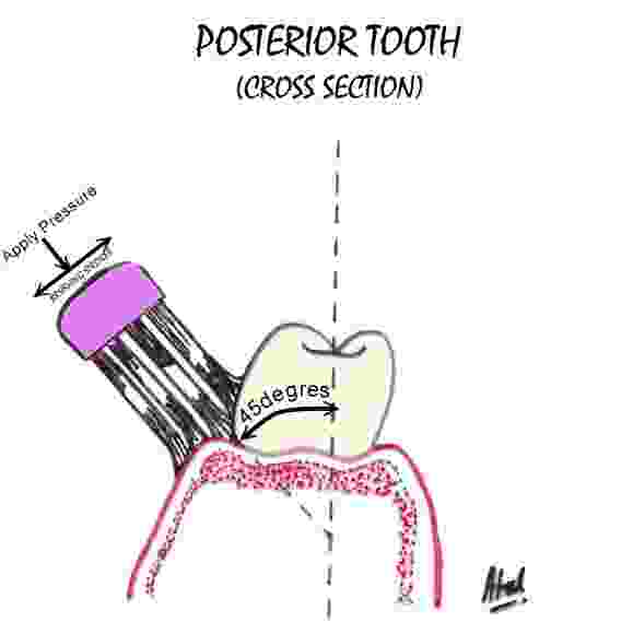 Proper technique of Brushing