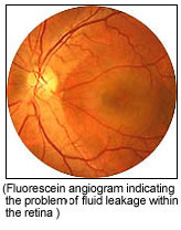 Dyes for Medicine,Fluoresce Dyes used for Medicine,Dyes used in ...