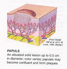 Papule