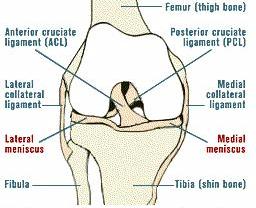 Torn Knee Cartilage