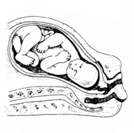 Stages Of Dilation In Pregnancy Baby In The Birth Canal: Birth