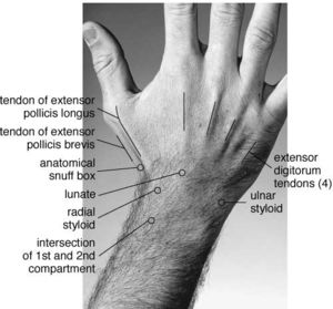 Hand & Wrist Injuries