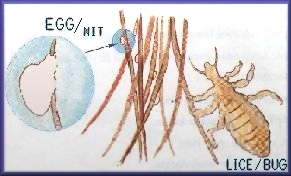 Identifying Lice and Nits