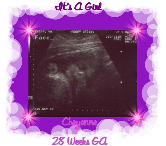 thirdtrimesterultrasounds
