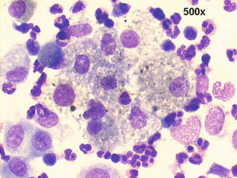 J.C. Prolla Cytopathology case 05A 2002