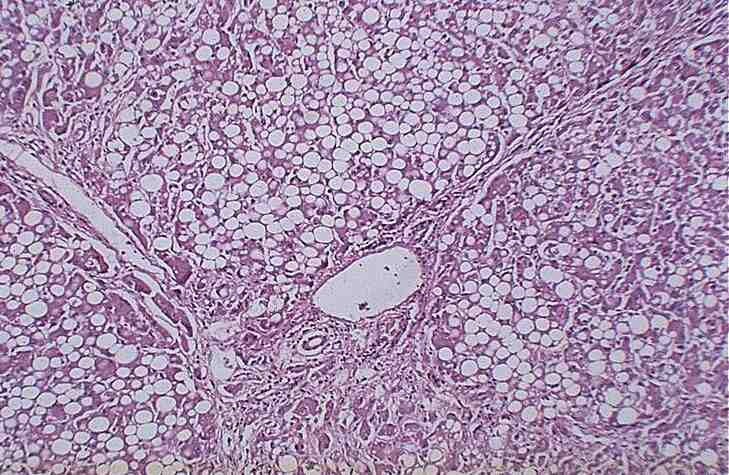 Liver Slide Histology