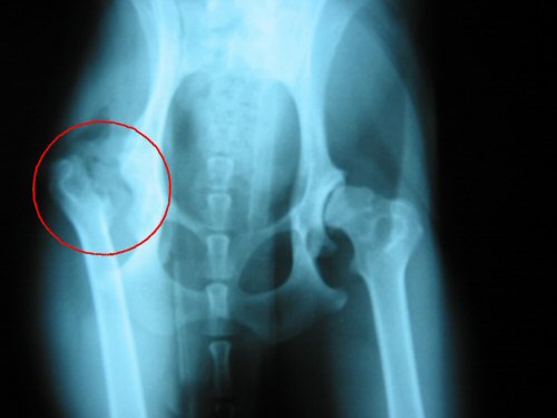 Femoral Head And Neck Ostectomy Fho
