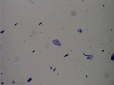 Human Cheek Cell 100x