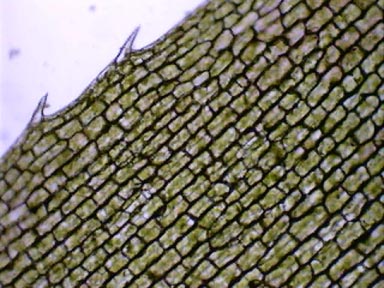 Elodea Cell Under Microscope 100x Biojournal: Microscope View Of