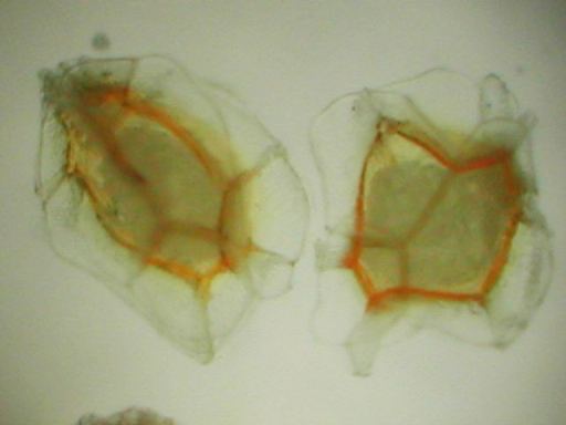 Orchid Seed and Polarised Light