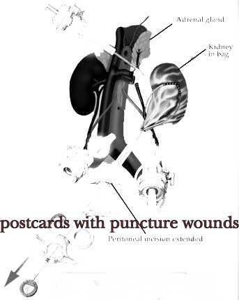 postcards with puncture wounds