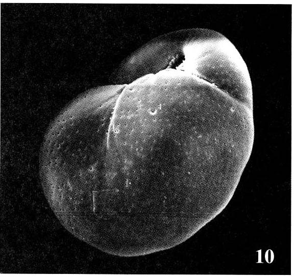 Easter Island Foraminifera