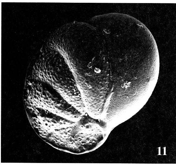 Easter Island Foraminifera