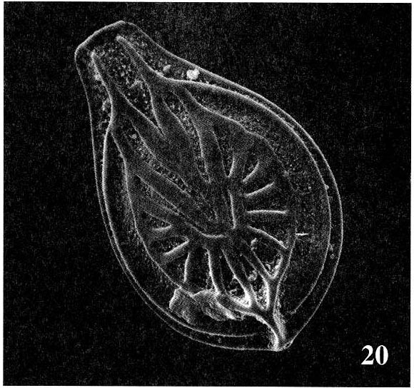 Easter Island Foraminifera