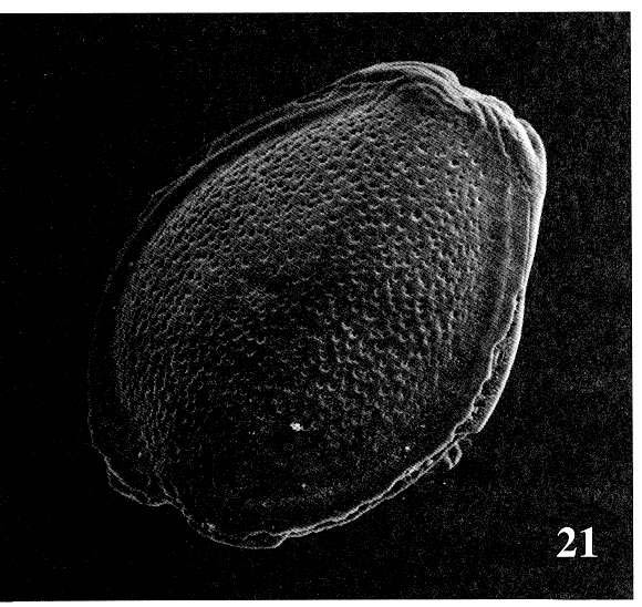 Easter Island Foraminifera