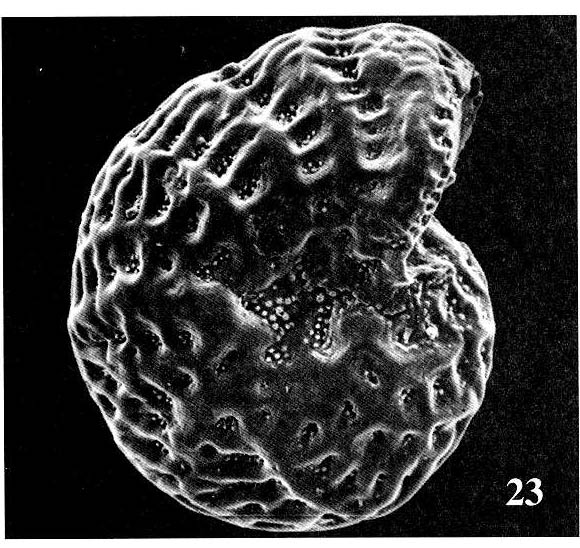 Easter Island Foraminifera