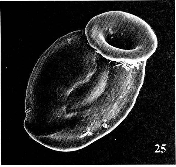 Easter Island Foraminifera