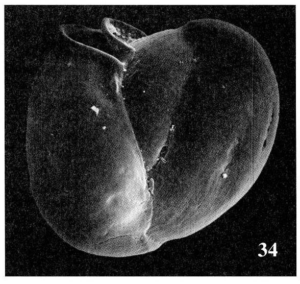 Easter Island Foraminifera