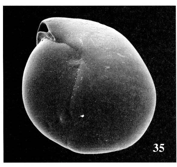 Easter Island Foraminifera