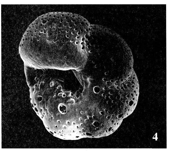 Easter Island Foraminifera