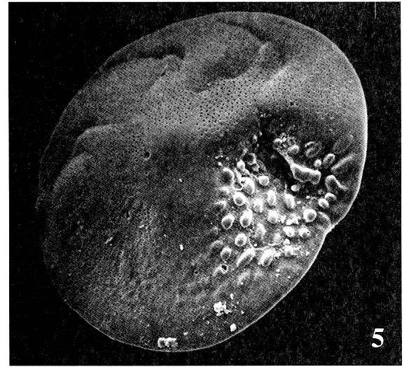 Easter Island Foraminifera