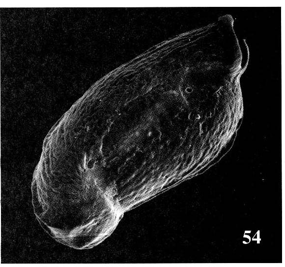 Easter Island Foraminifera