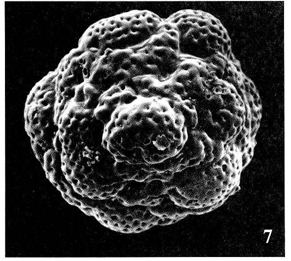 Easter Island Foraminifera
