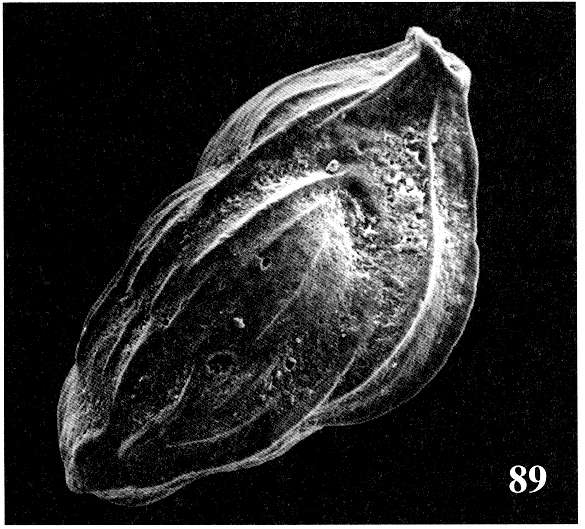 Easter Island Foraminifera