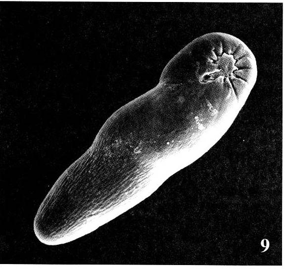 Easter Island Foraminifera