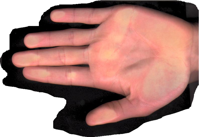 here israndy hand the hand did hrut when the scanner took it