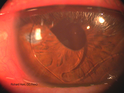 Photo Atlas, Page 1 - Richard Hom OD FAAO