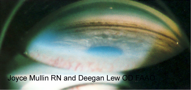 Photo Atlas, Page 1 - Richard Hom OD FAAO